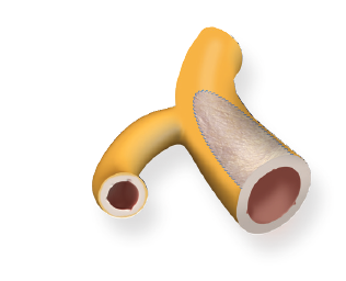 Advanta V12 | MAC's MEDICAL